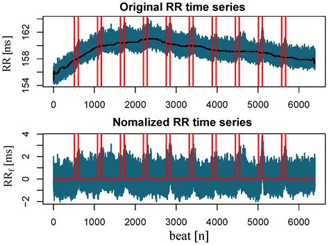 Dynamic Bayesian Model For Detecting Obstructive Respiratory Events By