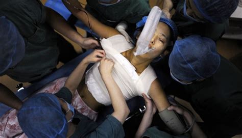 Melihat Proses Operasi Implan Payudara Tempo Co