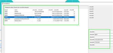 Xdata Expose Tdynamicproperties From Aurelius Model Tms Xdata Tms