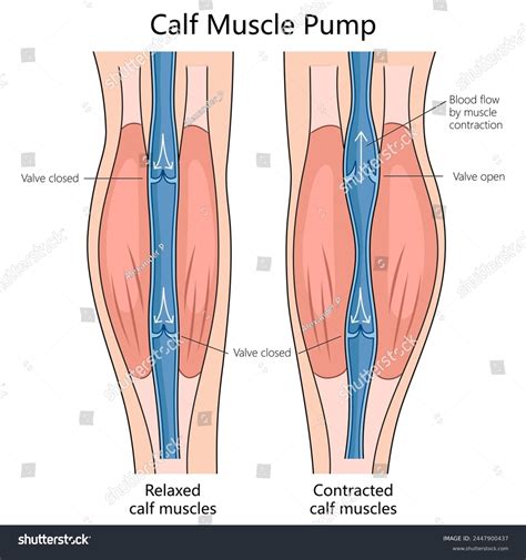 Calf Muscle Pump Over 51 Royalty Free Licensable Stock Illustrations And Drawings Shutterstock