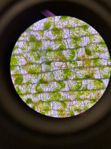Calculate The Extent Of Plasmolysis In Each Sucrose