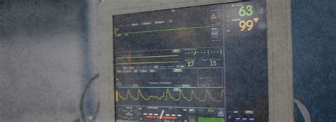 Kafka Connect Jmx Jconsole Docker Jamie Bowman