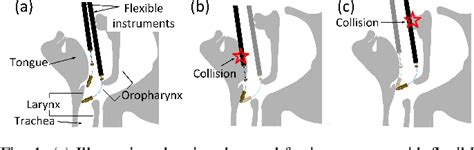 Figure 1 From A Variable Length Variable Stiffness Flexible Instrument For Transoral Robotic