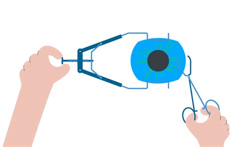 How To Fix A Lazy Eye As An Adult 2023 Update
