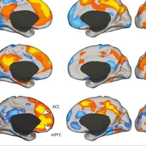 Hemispheric Specialization In Specific Cortical Regions A Download Scientific Diagram