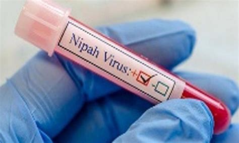 Kerala News जानिए कितना खतरनाक है Nipah Virus Shabd Sanchi