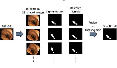 Figure 5 From Giana Polyp Segmentation With Fully Convolutional Dilation Neural Networks