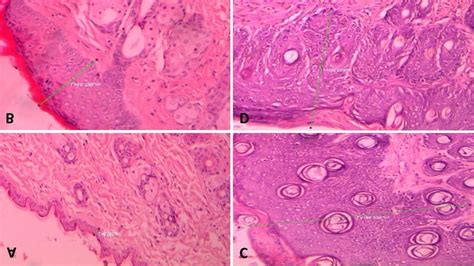 Calibrated Epidermal Proliferation In Different Group A Control Group