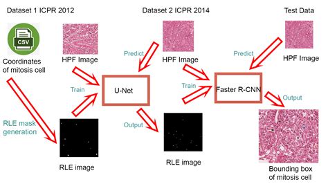 Breast Cancer Detection Using Deep Neural Network By Rohit Kumar Analytics Vidhya Jul