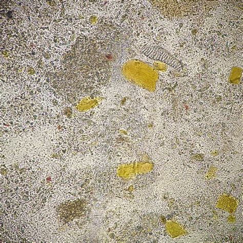 Human Stool Sample Under Microscope Stock Image Image Of Nature