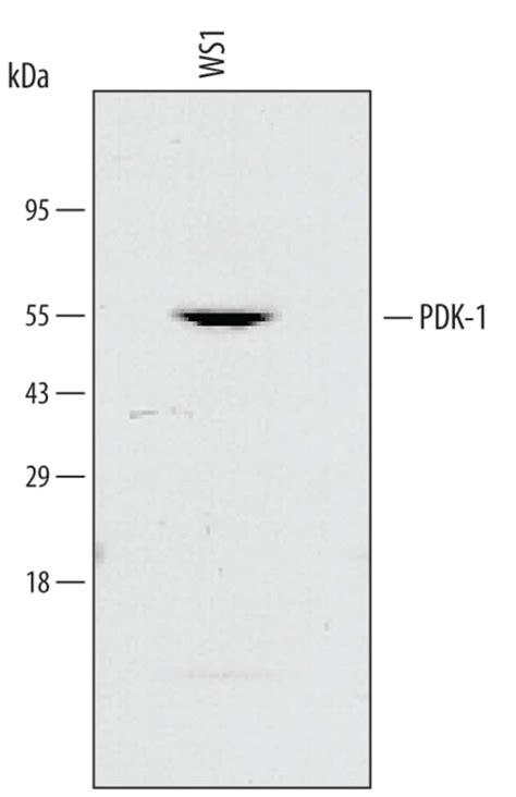 Human Pdk 1 Antibody R D Systems 100μg Unlabeledanticuerpos Fisher