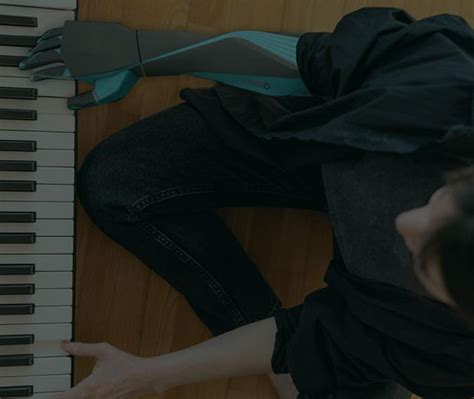 Cristina G On Linkedin Bionic Prostheses Regenerate Ukrainians