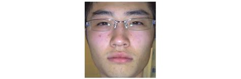 When Does Plastic Surgery Become Racial Transformation Plastic
