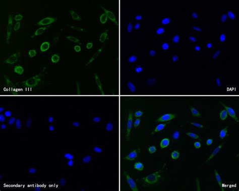 Collagen Iii Recombinant Monoclonal Antibody Je60 79 Ma5 44870