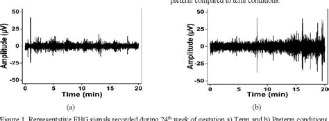 Spectral Correlation Density Based Electrohysterography Signal Analysis