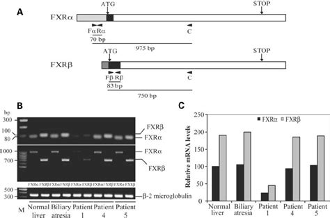Decreased Expression Of Fxr Isoforms In Patient 1 A Schematic Download Scientific Diagram