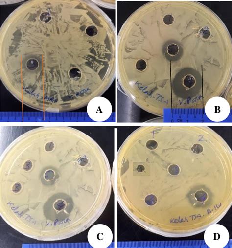 Table 1 From Isolation And Identification Of Potential Host Probiotic