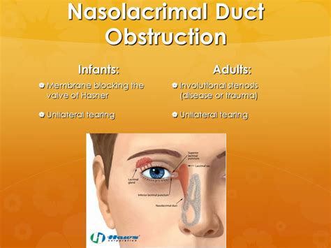 Lacrimal System Ppt Video Online Download