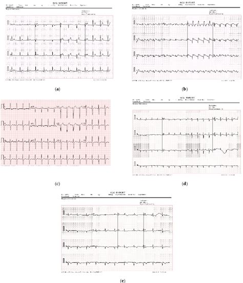 Figure 2 From A Robust Framework Combining Image Processing And Deep Learning Hybrid Model To