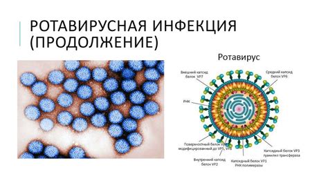 Острые кишечные инфекции презентация онлайн