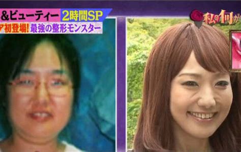 揭秘日本整容狂人狂人凤凰时尚