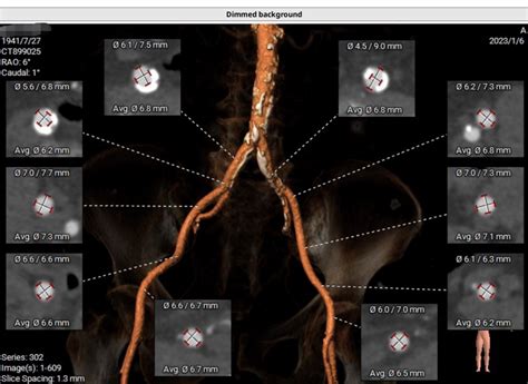 Tavr