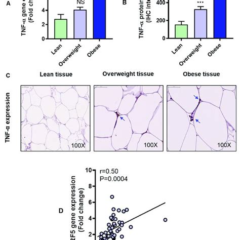 Increased Interferon Regulatory Factor 5 Irf5 Protein Expression In Download Scientific