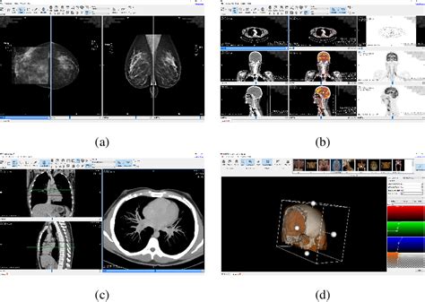 Figure 3 From Starviewer And Its Comparison With Other Open Source Dicom Viewers Using A Novel