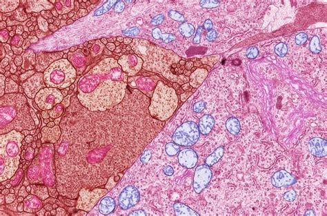 Retina Plexiform Layer Photograph By Steve Gschmeissner Science Photo Library Pixels