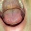 Berry Flavored Bruise Tumblr Com Tumbex Berry Flavored Bruise Tumblr Com Tumbex