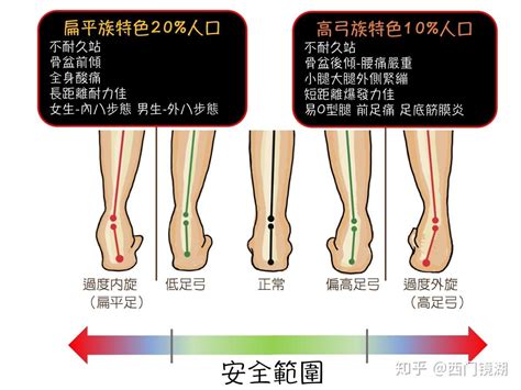 笔直大长腿 Xo腿追本溯源and对症下药篇足内翻足外翻 知乎