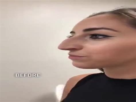 A Small Operation Makes A Huge Difference VIDEO Izismile Com