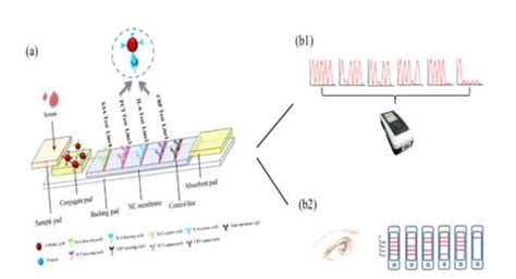 Quantitative And Ultrasensitive Detection Of Four Inflammatory Biomarkers By Gold Nanoparticle