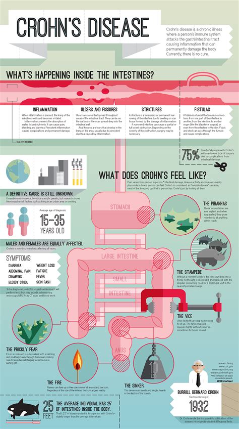 Crohns Disease An Infographic Behance