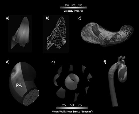 183 Computational Fluid Dynamics A Patient Specific Assessment Of The Thoracic Aorta Heart