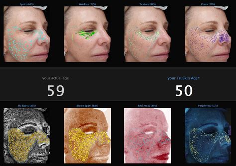 visia skin analysis south pasadena ca rejuvayou medical