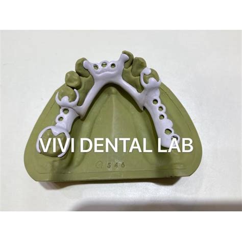 Cad Cam Peek Partial Denture Framework 3shape Exocad Denture Design From China Factory