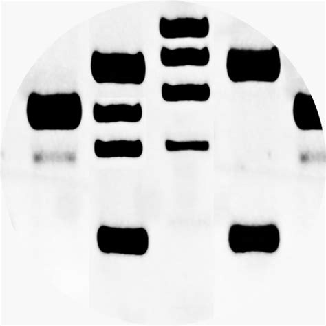 Western Blot Blocking Tips And Tricks