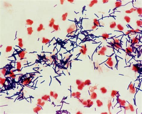 Lactobacillus Gram Stain