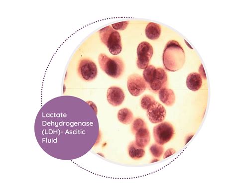 Lactate Dehydrogenase Ldh Mediscan Lab