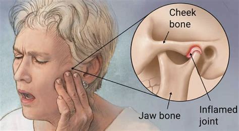 The Unexpected Connection Forward Head Posture And Tmj Disorders