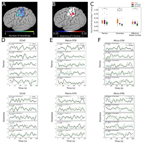Cortical Tremor And Slowness Decoding Models Were Distributed Download Scientific Diagram