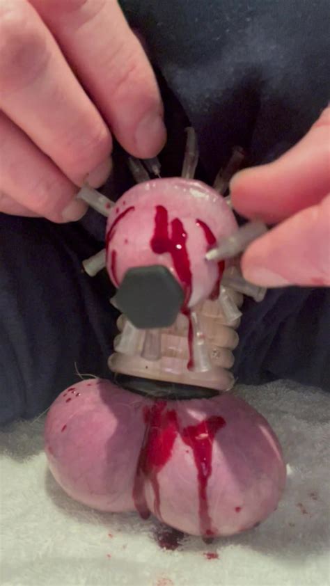 22 Needles Removed Deom Slaves Cock Head And Shaft