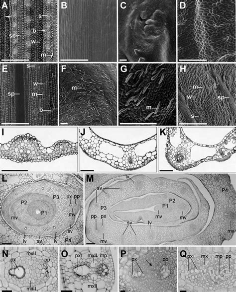 Epidermal Cell Types And Leaf Anatomy Of Wild Type 35s Oskn2 And Download Scientific Diagram