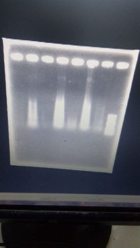 Questions With Answers In DNA ISOLATION Scientific Method