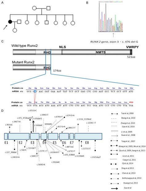 Novel Mutation Of Runx2 Gene In A Patient With Cleidocranial Dysplasia