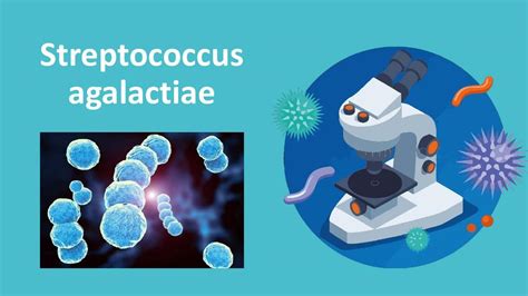 Streptococcus Agalactiae Jheniffer Udocz