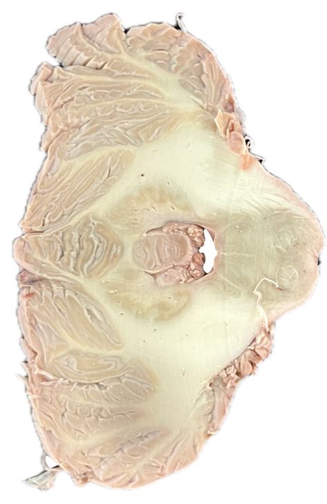 Brain Slice 15 Horizontal Diagram Quizlet