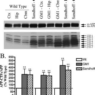 Progressive LC II Accumulation In NPC Mouse Brains A Representative Download Scientific