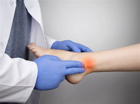 Maladie de Sever : origine, symptômes, traitement... | Pharmacie Des ...